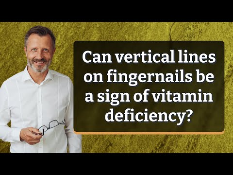 Can vertical lines on fingernails be a sign of vitamin deficiency?