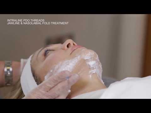 Intraline PDO Thread Treatment