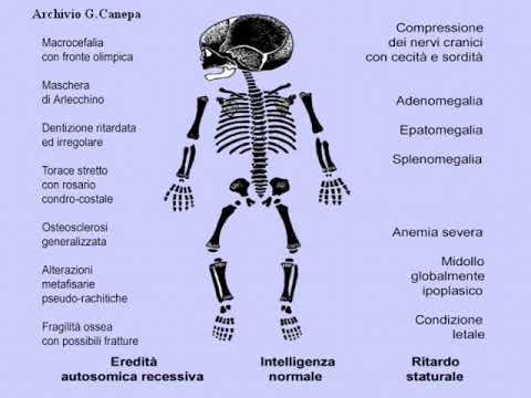 Z25 osteopatie congenite sclerosanti 1 106 buono