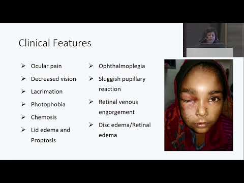 AIOC 2023 IC410 topic Dr SAHIL AGRAWAL Bacterial Orbital Infections Challenges and Perspectives