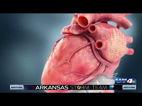 New Dual Treatment at Baptist Health for AFib