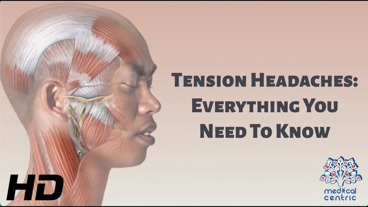 Tension Headaches: Everything You Need To Know