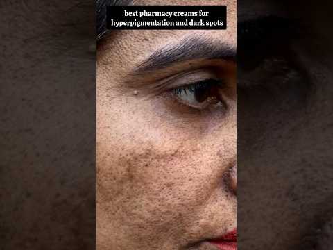Demelan Cream for Dark Spots & Pigmentation | Dermatologist Recommended #darkspots