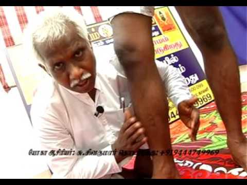 VARMA THERAPY-வர்ம மருத்துவம்-PART-4 கால் சார்ந்த வர்மங்கள்2