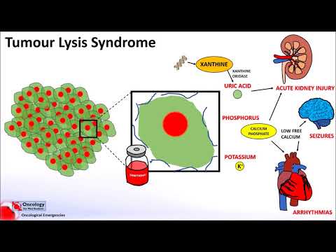 Tumour Lysis Syndrome