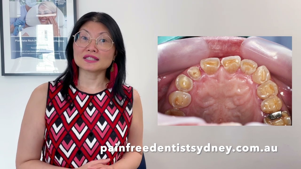Unlocking the Connection: Sleep Apnea & TMJ