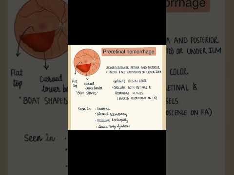 Different Retinal Haemorrhages in Different Diseases and their location in Retinal Layers#retina