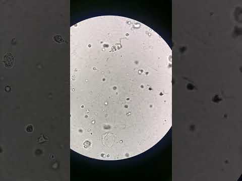 Urine sediments : white blood cells or pus cells #laboratory #microscope #medtechstudent #mls #cls