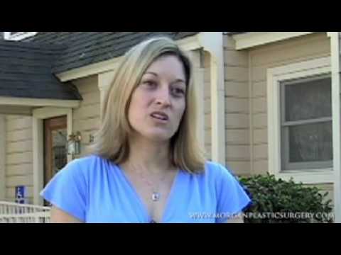 Detailed Cosmetic Surgeon in Chico, CA