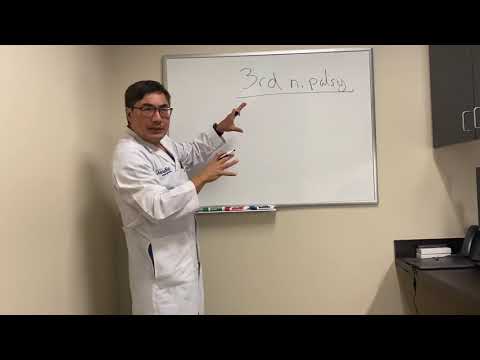 Incomplete third nerve palsy- approach