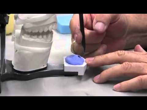 Making a Custom Anterior Guide Table | Foundation for Oral-facial ...