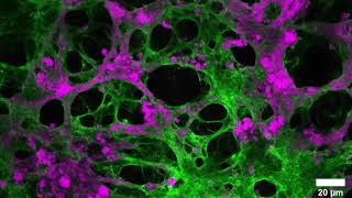 Advanced Electron Microscopy :: mineralized tissues