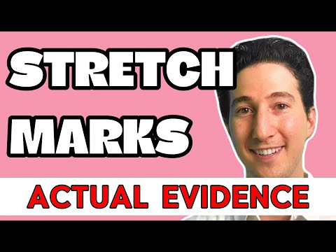 The EVIDENCE Behind Stretch Marks From a Dermatologist