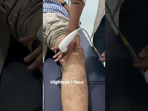 I-Tecar therapy for knee pain
