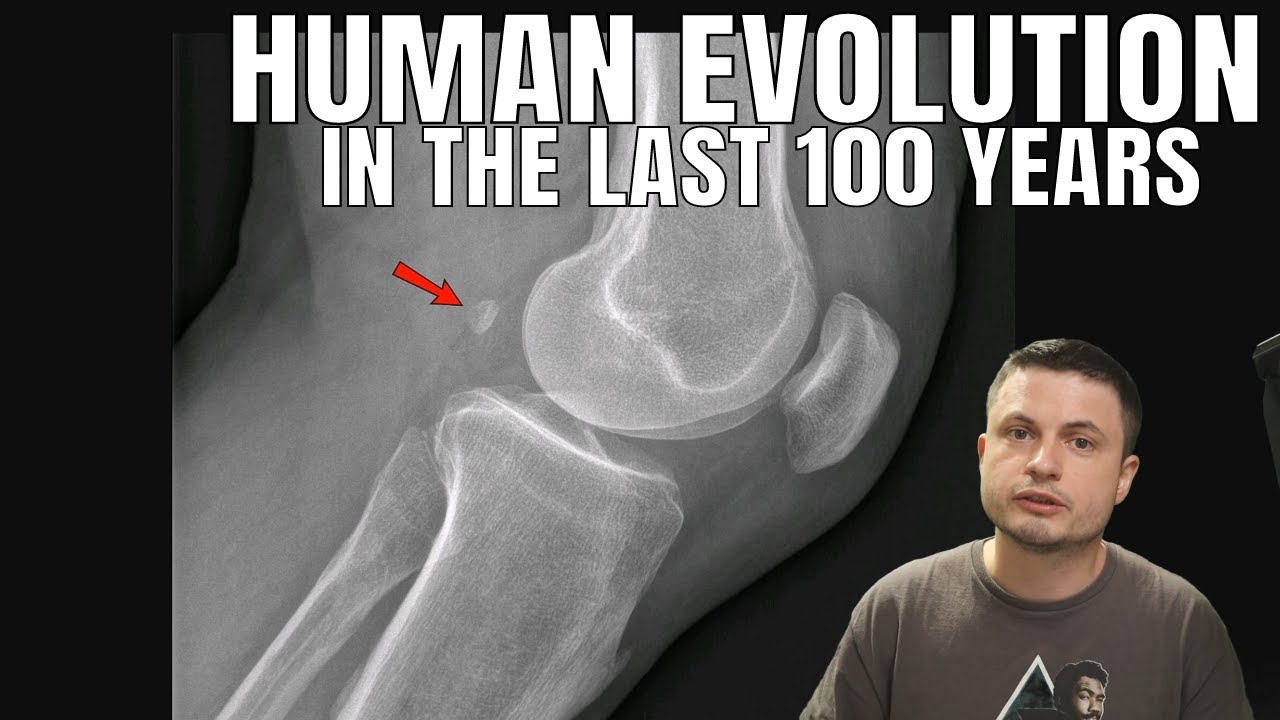 Here's How Humans Have Evolved In the Last 100 Years
