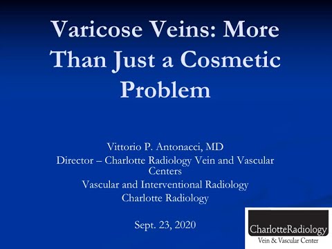 Advancing Patient Care with Radiology - Varicose Veins - More Than Just A Cosmetic Problem