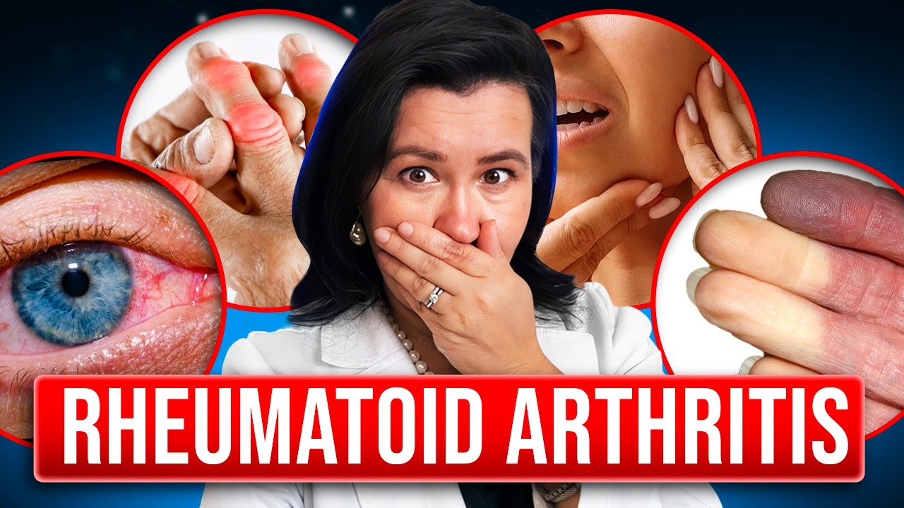 8 DEADLY Signs of Rheumatoid Arthritis