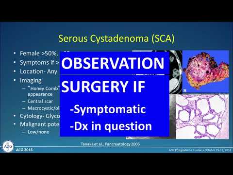 Pancreatic Cysts – Making Sense of Differing Guidelines