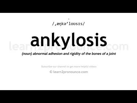 How to pronounce Ankylosis | English pronunciation