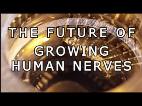 Building A Human Nerve For Faster Drug Development (AXOSIM)