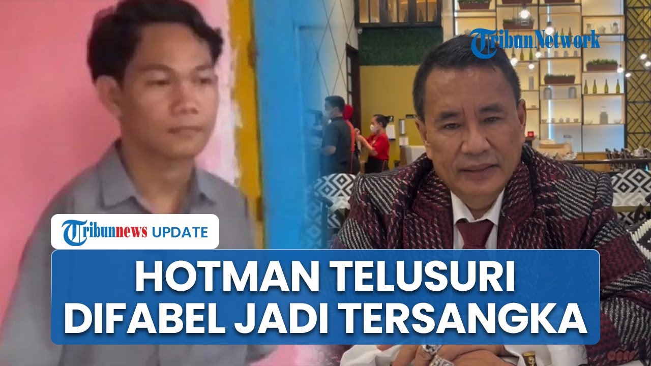Hotman Telusuri Kasus Pemuda Disabilitas Asal Mataram Agus Buntung yang ...