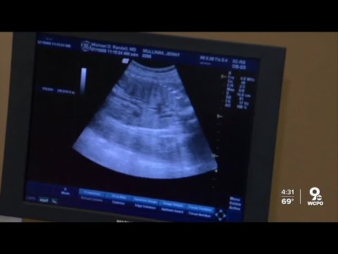 Here's where abortion law stands across the Tri-State