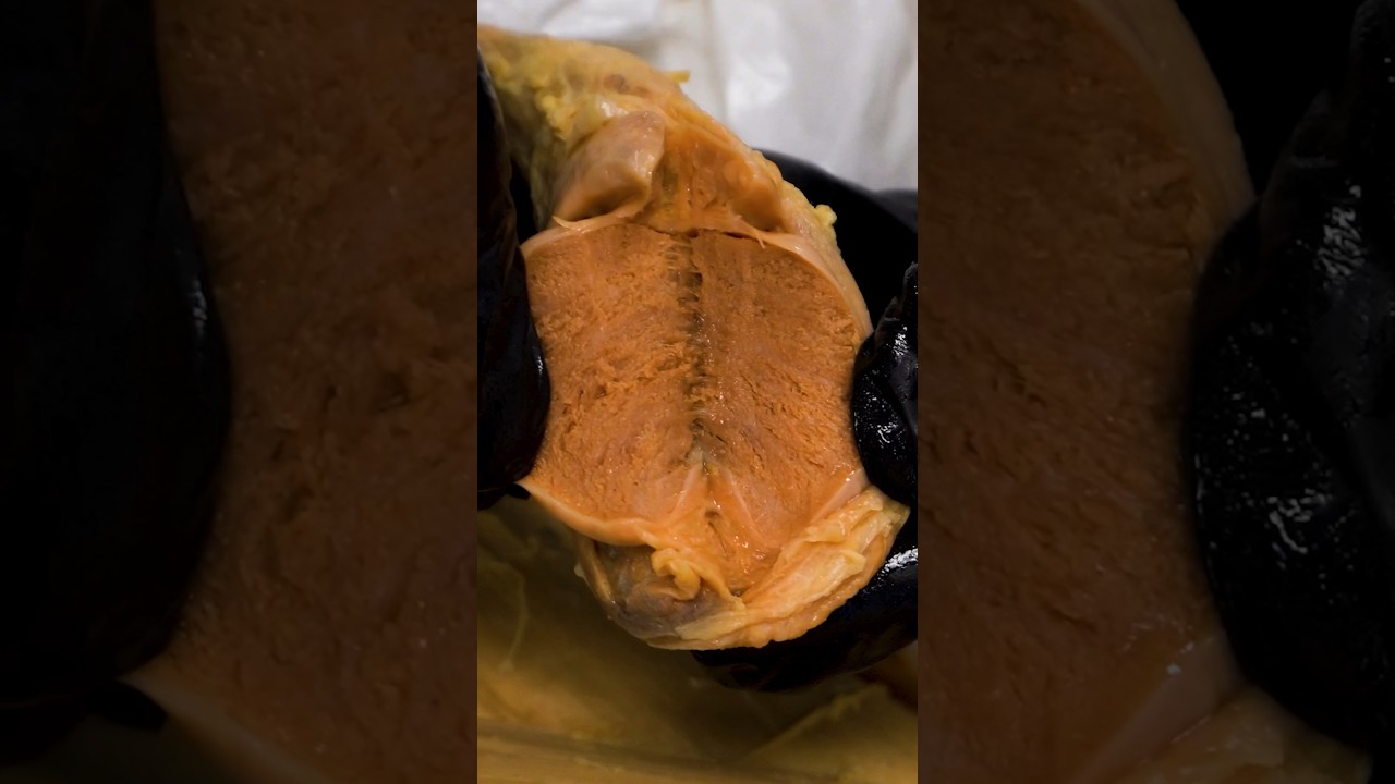 Where Sperm Are Produced & Stored!