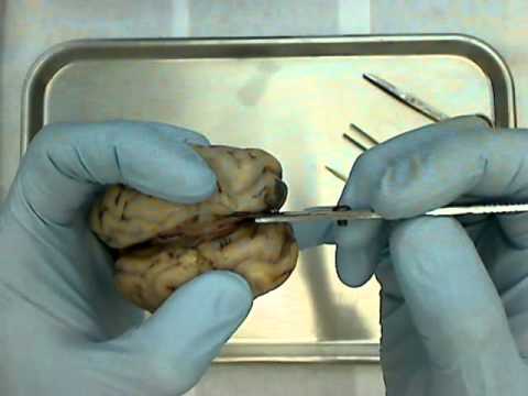 sheep brain dissection