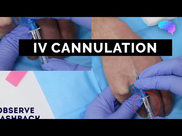 A Step-by-Step Guide to Intravenous Cannulation | Galaxy.ai | Galaxy.ai