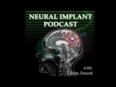 Dr David Friedenberg talks about gradiated muscle control in an implanted patient