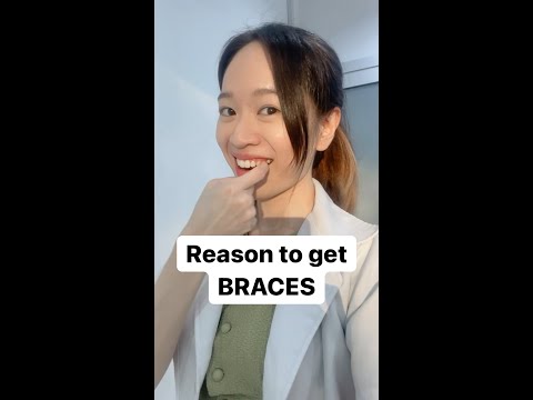 Reason to get Braces?🤔 #Shorts