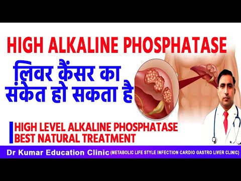 लिवर कैंसर का संकेत हो सकता है// HIGH LEVEL ALKALINE PHOSPHATASE BEST NATURAL TREATMENT