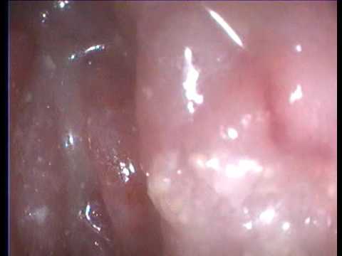 Cats oesophagus. Vascular ring anomaly. Megaesophagus .