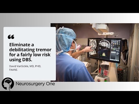Expert-Approved Treatment for Essential Tremor