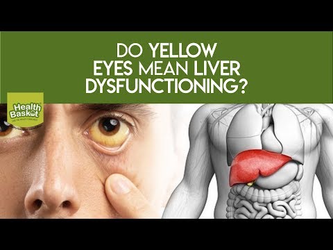 Do yellow eyes mean liver dysfunctioning?