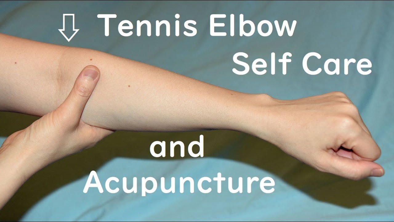 Self Care and Acupuncture for Your Tennis elbow / Lateral Epicondylitis