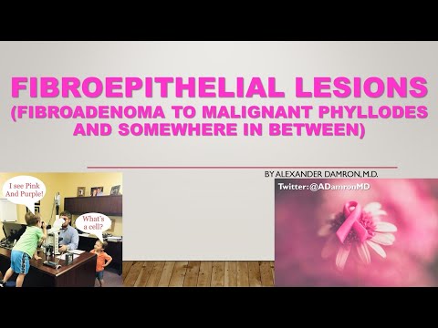 Fibroepithelial Lesions (Fibroadenoma to Malignant Phyllodes)