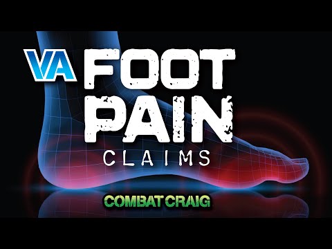VA Claims for Foot Pain: Plantar Fasciitis and Flat Foot VA Ratings