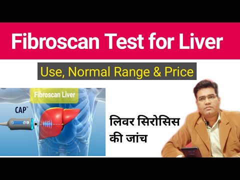 What is Fibroscan Test for Liver - Explained in Hindi | Use, Price and Normal Range