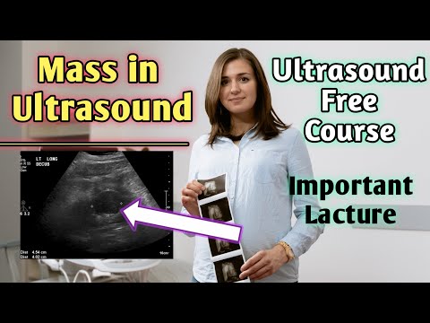 Can masses be seen on ultrasound? | Does hypoechoic mass mean cancer?