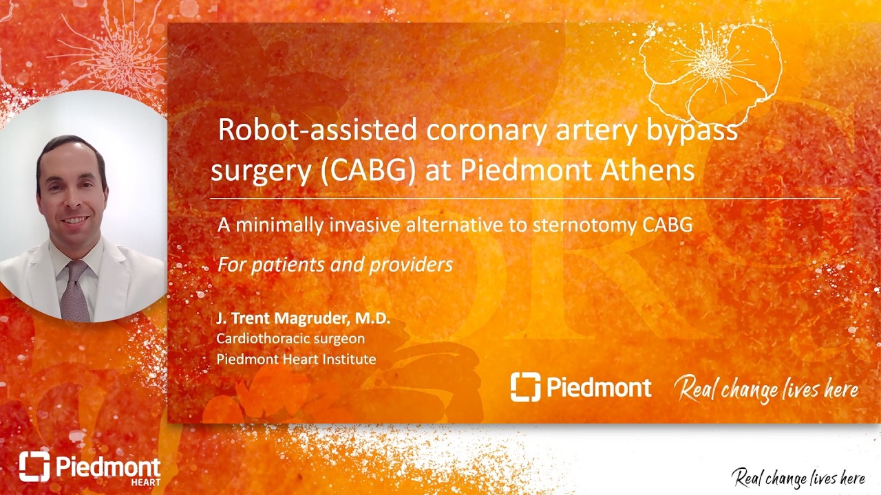 Robotic Minimally Invasive Coronary Bypass (MIDCAB)| Patient Overview