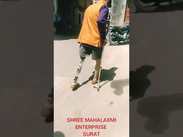 Above Knee Prosthesis - TES Suspension Belt Manufacturer from Surat