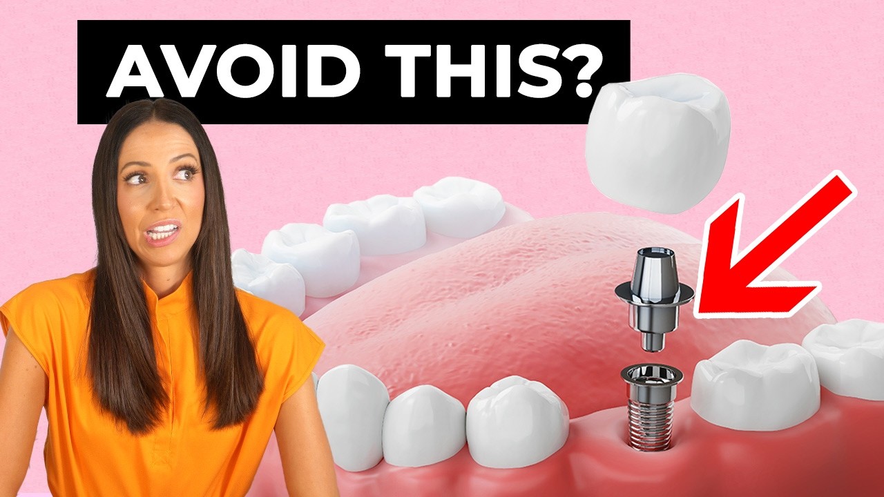 Should You Avoid Dental Implants?