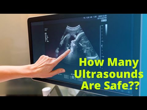 Ultrasound During Pregnancy: How Many Scans Are Necessary? | Complete Guide