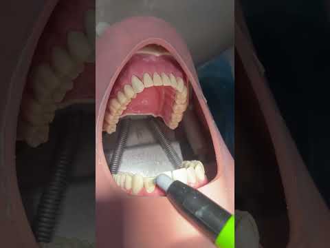here’s how dentists make veneers 🦷 #dentist #dentalschool #dentistry #turkeyteeth