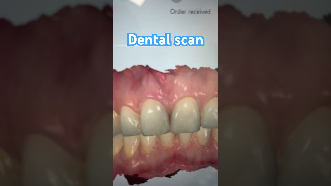 Dental scan #dentalscan #dentalassistant #dentalcare #dentalhealth #dentalhygiene