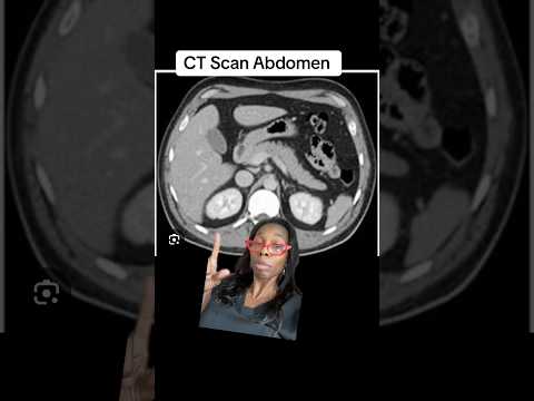 The Truth Revealed: What a CT Scan of the Abdomen Shows