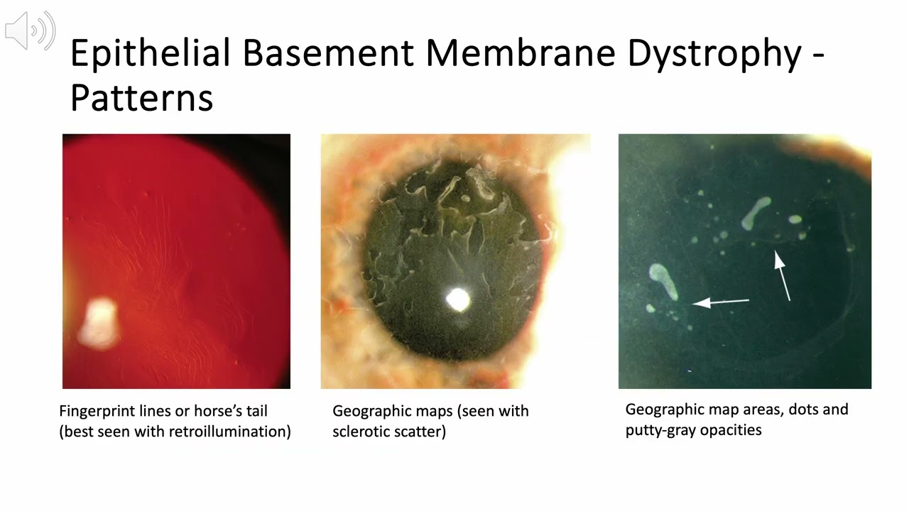 Cornea Chapter 8