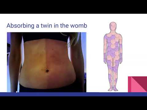What is Human Chimera?