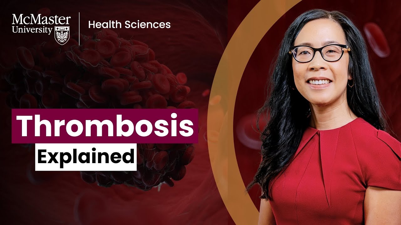 What you need to know about thrombosis